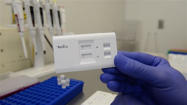 Bộ test đặc biệt giúp chẩn đoán bệnh truyền nhiễm - Benh.vn